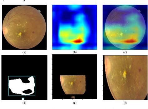 Figure 1 From A Multi Label Detection Deep Learning Model With Attention Guided Image