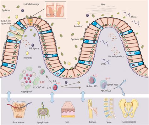 Subclinical Gut Inflammation Observed In Axial Spa Is Associated To