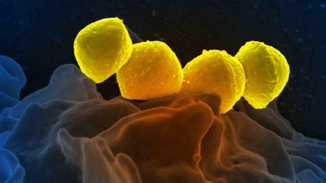 What You Should Know About Strep A The Usually Mild Infection Killing