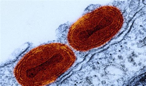 Mpox Clade 1b Spreads To More African Countries Cidrap