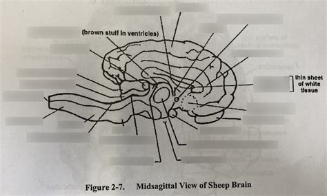 Midsagittal View Of Sheep Brain Diagram Quizlet Midsagittal View Of Sheep Brain Diagram Quizlet