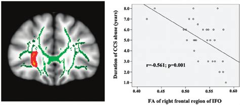 Correlations Between Mean Fractional Anisotropy Of The Right Frontal