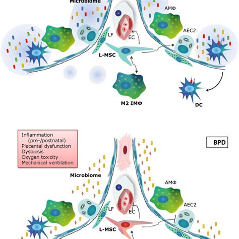 A Schematic Overview Of The Pathophysiology Of Bronchopulmonary