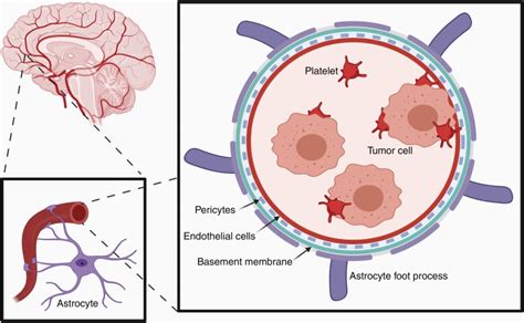 The Microenvironment Of Brain Metastases From Solid Tumors Pmc