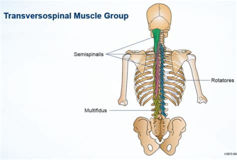 Cross Sectional Anatomy The Spine Part 2 Flashcards Quizlet