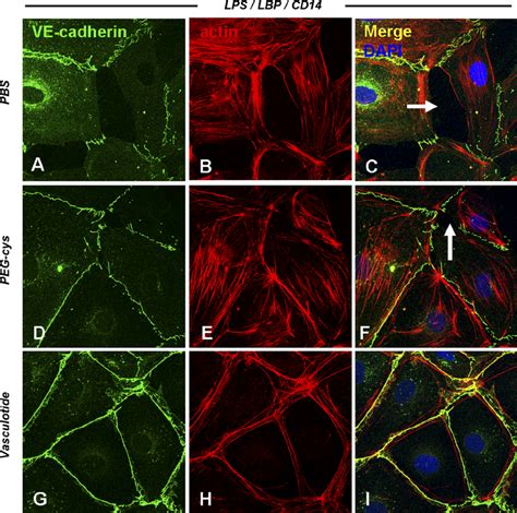 Vasculotide Vt Prevents Endothelial Cytoskeletal Disruption Induced Download Scientific