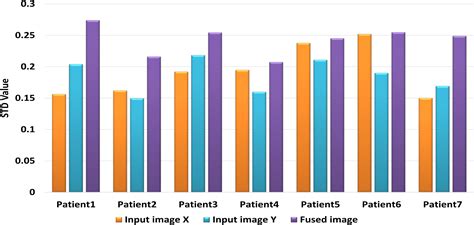 A Novel Perceptual Two Layer Image Fusion Using Deep Learning For Imbalanced COVID Dataset