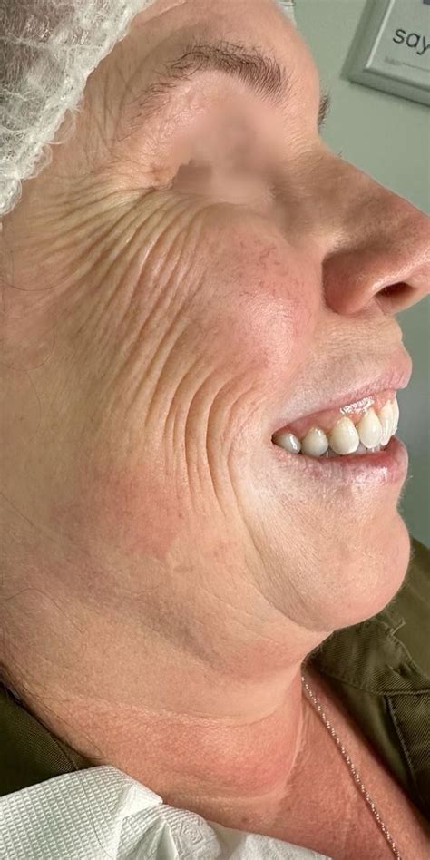 Kate Mullane Heidi Rose Aesthetics Glowday