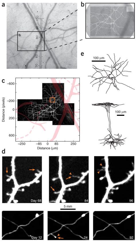 Long Term High Resolution Imaging In The Mouse Neocortex Through A Chronic Cranial Window