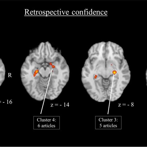 Brain Maps Showing Significant Activation Likelihood Estimation Ale Download Scientific