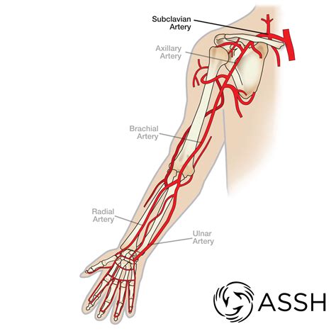 Radial Artery Understanding Transradial Cardiac Catheterization