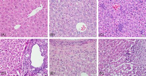hematoxylin‐eosin he staining of liver in mice infected with