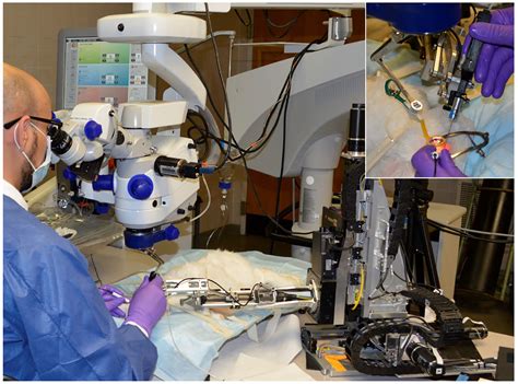Robotic Assistance For Intraocular Microsurgery Challenges And