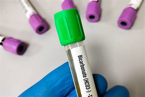 Recipe Of The Week Week Bicarbonate Indicator SciChem