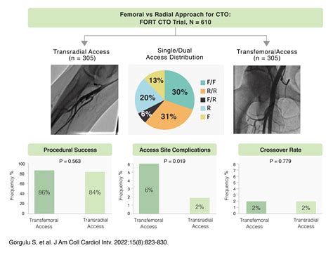 Radial Access For Complex Pci Terumo Interventional Systems