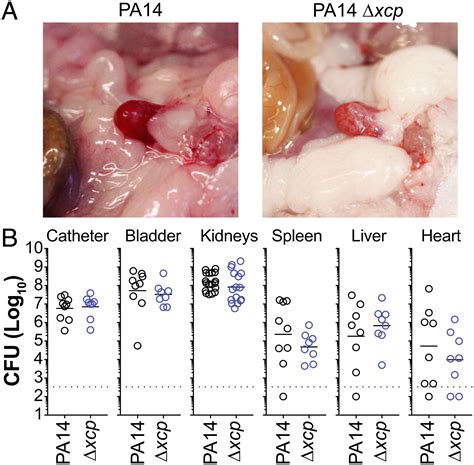 Pseudomonas Infection Urine