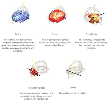 Initial Analysis Brain Treatment Glenview IL