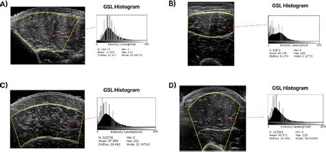 Figure 2 From Muscle Cross Sectional Area Segmentation In Transverse