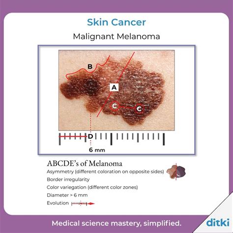 Ditki Medical And Biological Sciences On Linkedin Students Having A