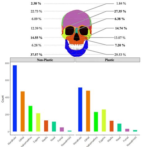 Facial Fracture Treatment Prevalence By Fracture Location And Sex The