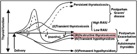 Postpartum Thyroiditis Wikiprojectmed