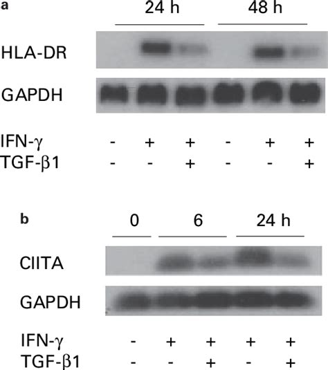 Figure 1 From Stat1 Independent Down Regulation Of Interferon Gamma Induced Class Ii