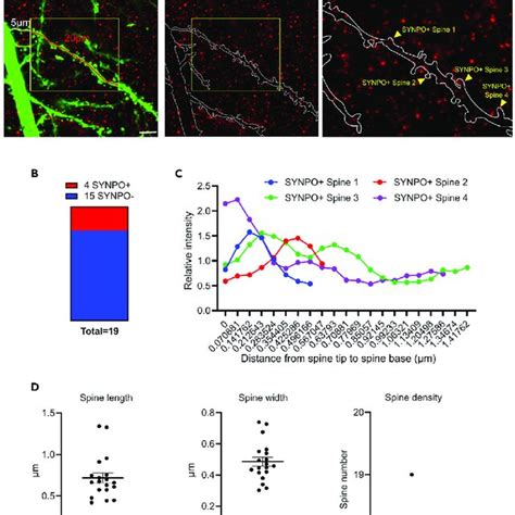 Determination Of Dendritic Spine Features A Representative Results