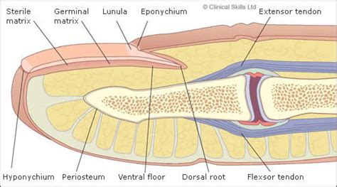 Soft Tissue Injuries Of The Hand Rcemlearning India