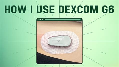 How I Use Dexcom G6 Youtube