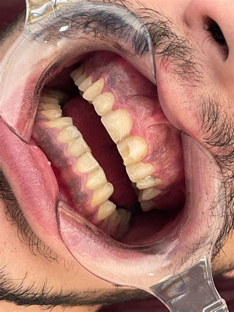 Mojgan Dasturi On Linkedin Composite