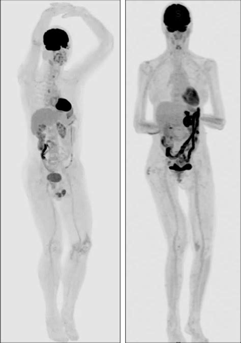 New Scanner Captures 3D Image Of Entire Human Body At Once