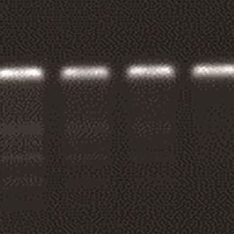 Results Of The Sensitivity Test For Nested Pcr 100 10 1 01 001