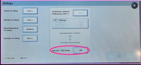 Biventricular Algorithms Crt Programming Biventricular Algorithms Crt Programming