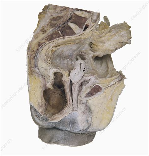 Human Dissection Stock Image C0126287 Science Photo Library