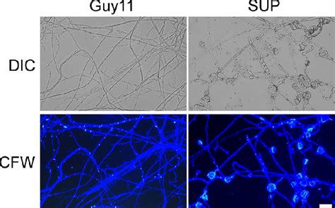 Figure 3 From Bacillus Subtilis Klbmpgc81 Suppresses Appressorium
