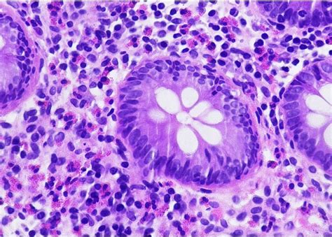 Pathology Pathologist Endoscopy Dr Rawia Mohamed