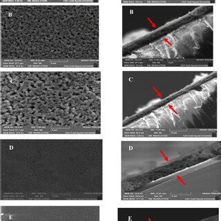 SEM Images A B C D And E Surface Morphology Of The Download Scientific Diagram
