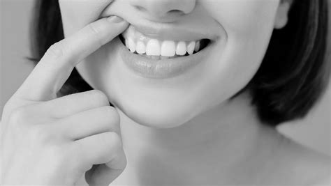 Is Gingivitis Reversible Dental Health Society