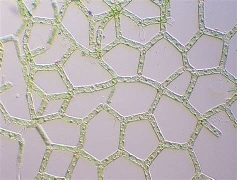 Microscopic View Of Green Algae Magnified At High Scale Photo Background And Picture For Free