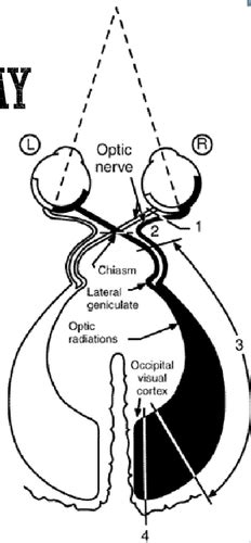 6 Confrontational Visual Field Flashcards Quizlet
