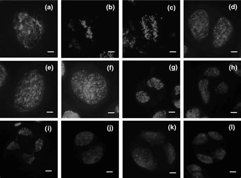 Male Meiosis Stages Of ‘towaakane Stained With Dapi A Pachytene B Download High Quality