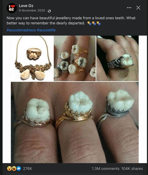 My Uncle Gave Me One Of His Teeth For My Birthday R Oddlyterrifying