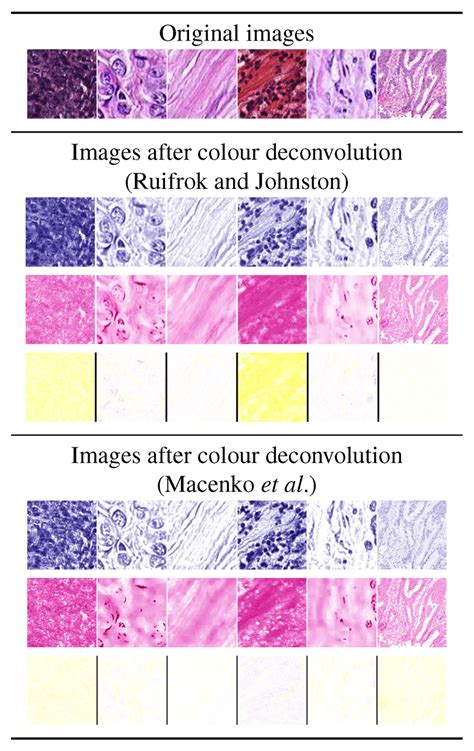 Effects Of Colour Deconvolution Through Ruifrok And Johnstons 26