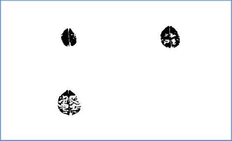 3 segmented images the pre processed image is moved to the next level