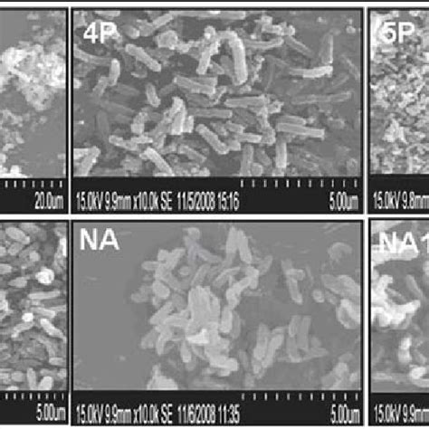 Scanning Electron Microgram Of Morphological Features Of Six Marine