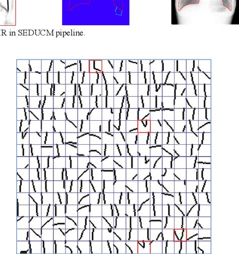 Figure From Lung Field Segmentation In Chest Radiographs From Boundary Maps By A Structured