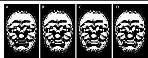 Figure 1 From Shape Based Classification Of 3d Facial Data To Support