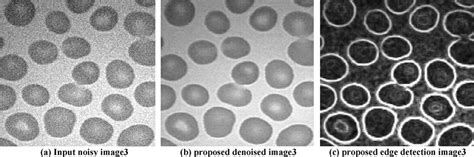 a input noisy image 3 b proposed denoised image 3 c proposed edge
