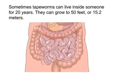 Tapeworm Infection