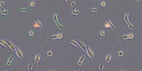 How To Use Cellpose With Google Colab Image Analysis Image Sc Forum